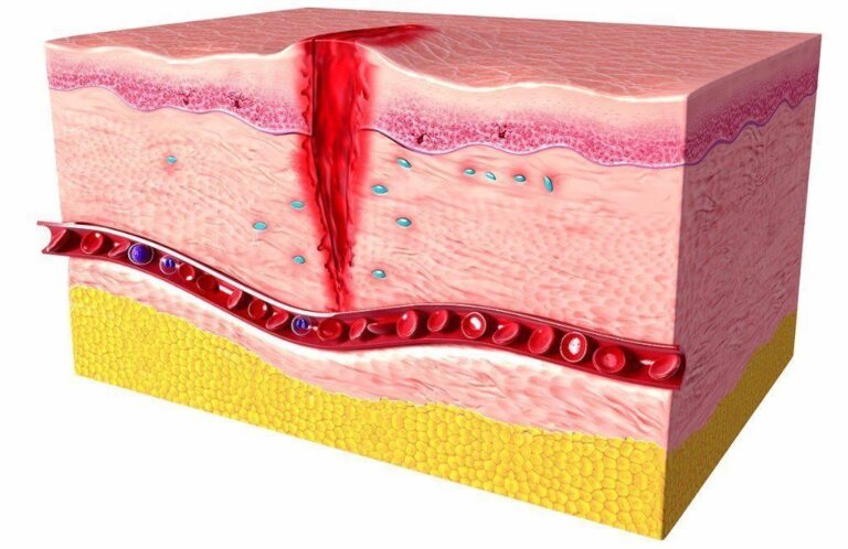 Lacerations – Medical Center of Marin | Urgent Care Clinic & Health ...